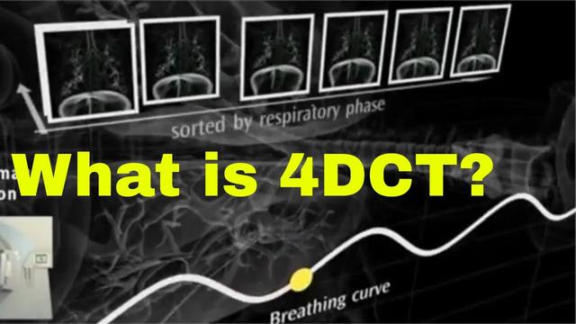 Everything You Need To Know About 4d Ct Simulation